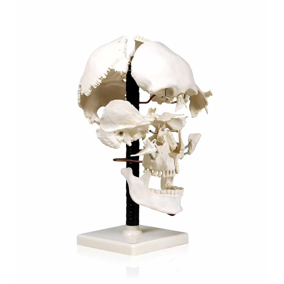 Exploded Human Skull Model - MYASKRO